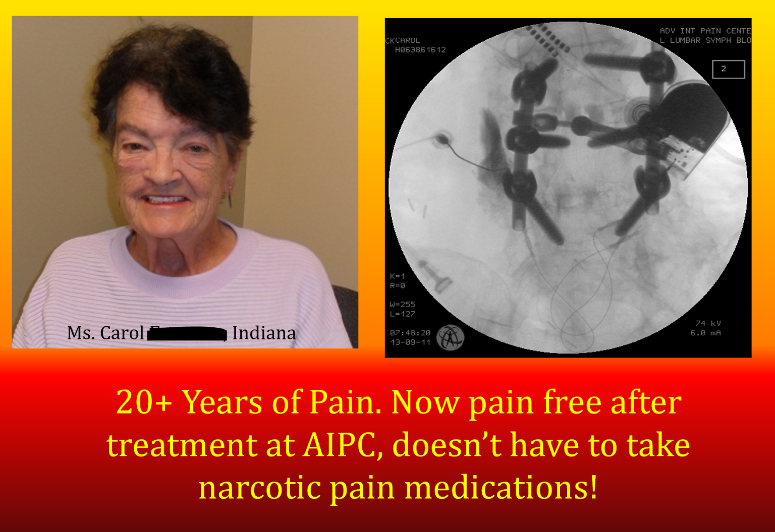 World's No.1 Interventional Pain Center - Advanced Interventional Pain ...